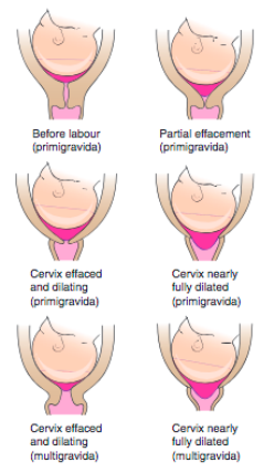 MIDW1101 Lecture Notes - Fall 2018, Lecture 3 - Uterotonic, Uterine ...