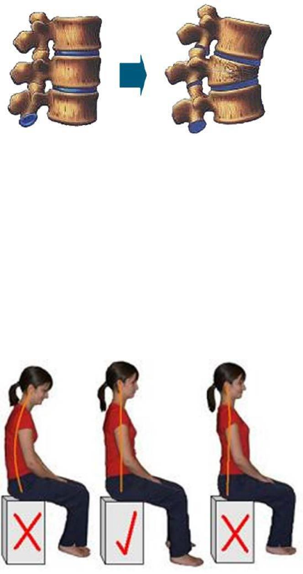 PHTY103 Lecture 2: Observation of posture and gait - OneClass